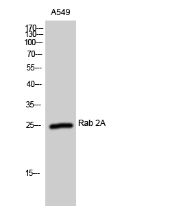 Rab 2A Monoclonal Antibody- ELISA科研检测中心-优品生物官网