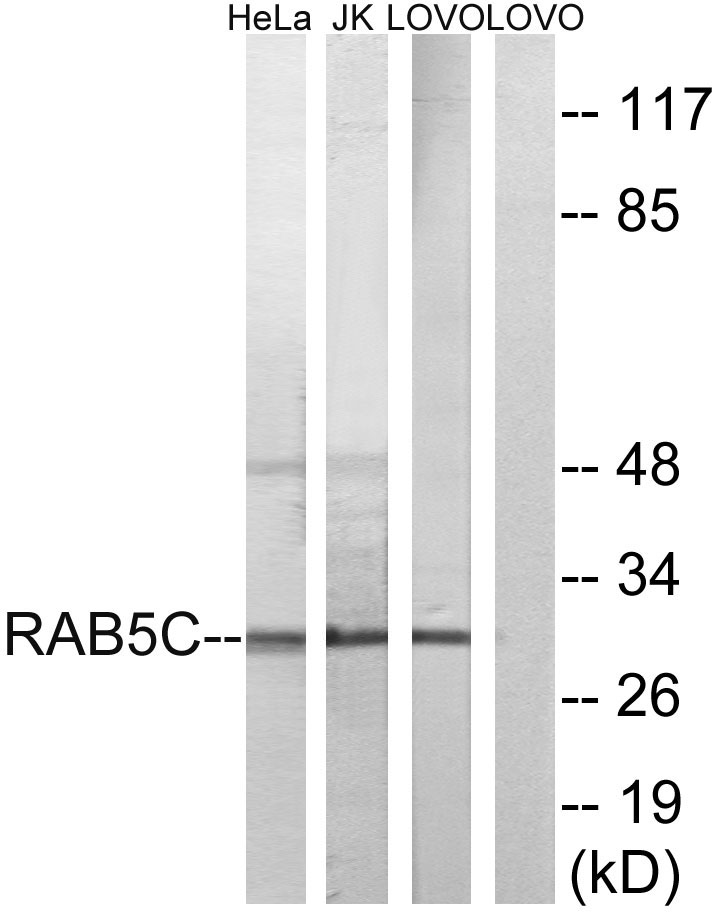Rab 5C Monoclonal Antibody- ELISA科研检测中心-优品生物官网