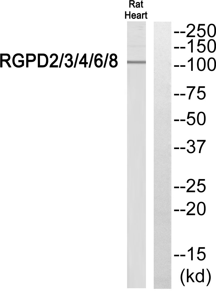 RGPD2/3/4/6/8 Monoclonal Antibody- ELISA科研检测中心-优品生物官网