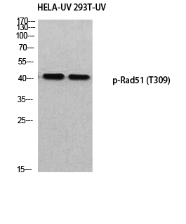 Rad51 (phospho Thr309) Monoclonal Antibody- ELISA科研检测中心-优品生物官网
