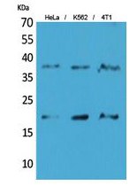 STING/TMEM173 Monoclonal Antibody- ELISA科研检测中心-优品生物官网