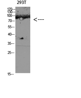 CD168 Monoclonal Antibody- ELISA科研检测中心-优品生物官网